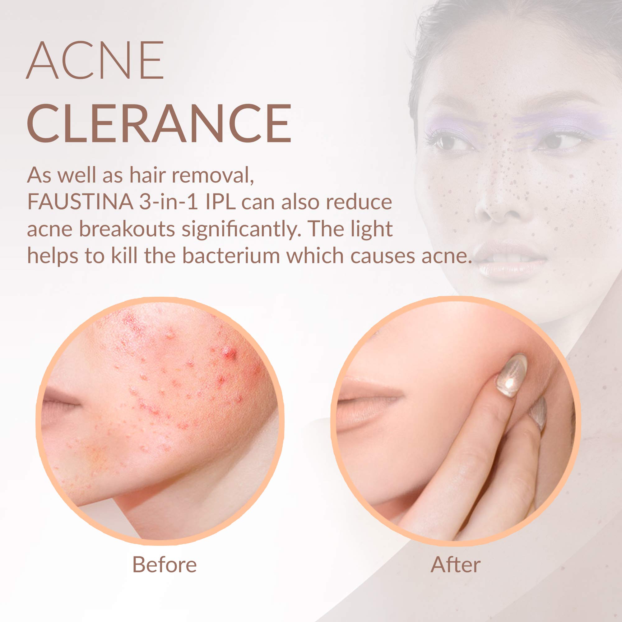 FAUSTINA 3-in-1 IPL (3 Lamps 1,500,000 Shots) Hair Removal, Skin Rejuvenation, and Acne Clearance Device - Completely Painless - Full Results After 3-7 Treatments - Free Pouch & Sunglasses.