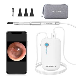 teslong otoscope, video otoscope with light, digital otoscope with ear wax removal tools, ear camera for android phone, usb, with ear picks