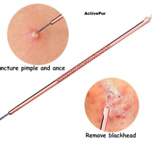 Blackhead Remover Pimple Comedone Extractor Tool, Effective Acne Removal Kit, Treatment for Blemish, Whitehead Pimple Popping, Zit Removing for Nose & Face Skin, Best Electroplated 4 PCS w/case.