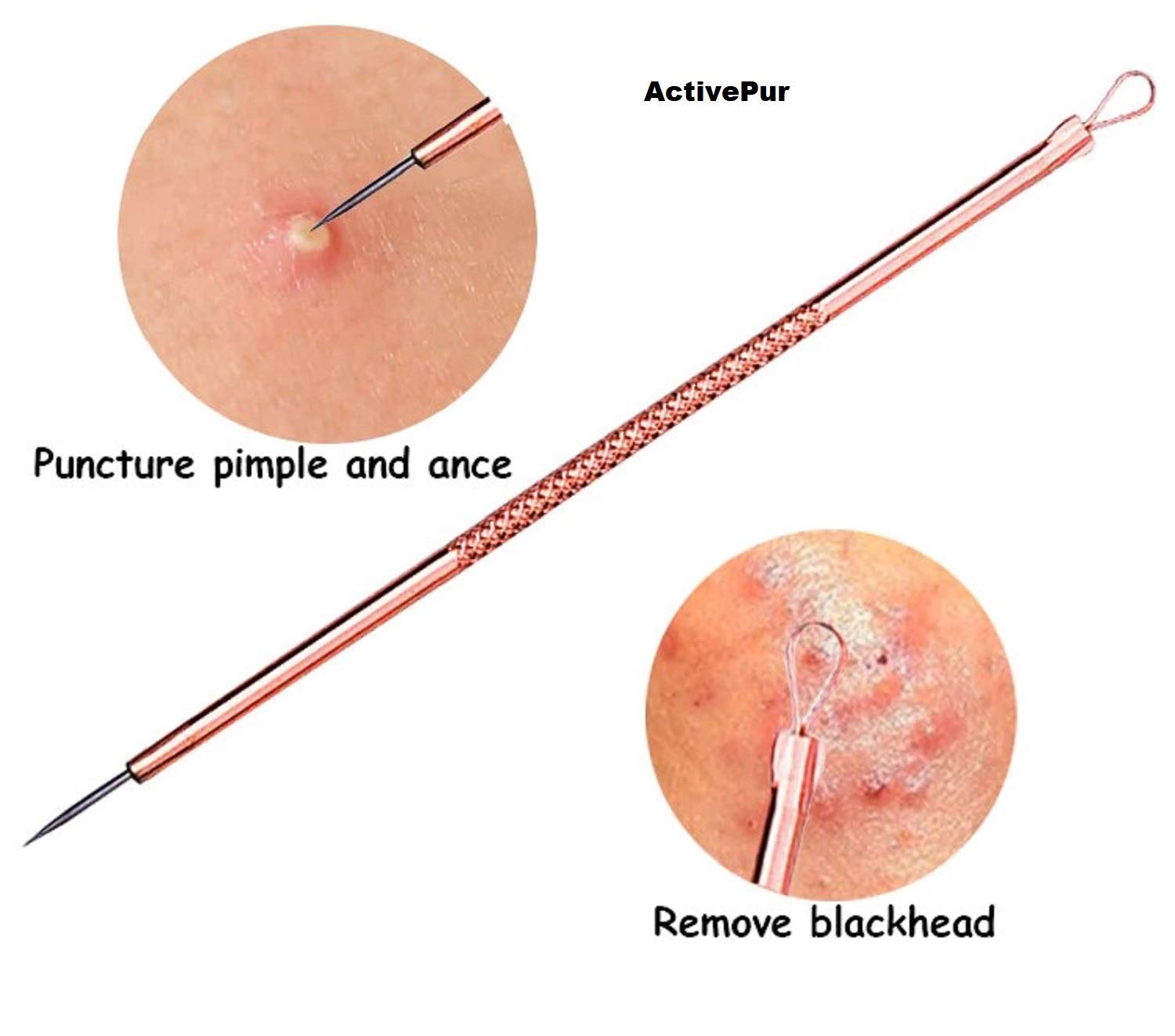 Blackhead Remover Pimple Comedone Extractor Tool, Effective Acne Removal Kit, Treatment for Blemish, Whitehead Pimple Popping, Zit Removing for Nose & Face Skin, Best Electroplated 4 PCS w/case.