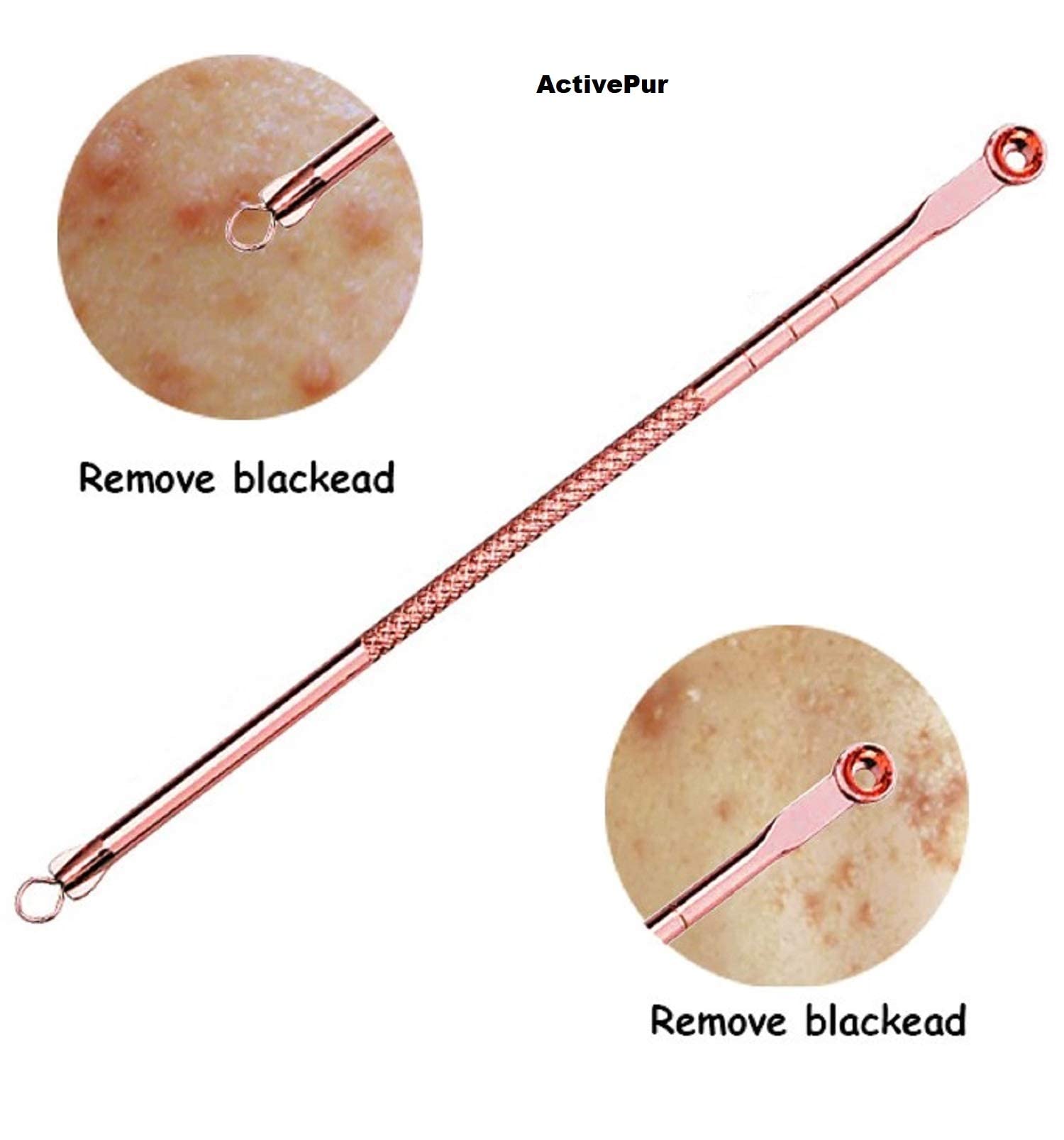 Blackhead Remover Pimple Comedone Extractor Tool, Effective Acne Removal Kit, Treatment for Blemish, Whitehead Pimple Popping, Zit Removing for Nose & Face Skin, Best Electroplated 4 PCS w/case.