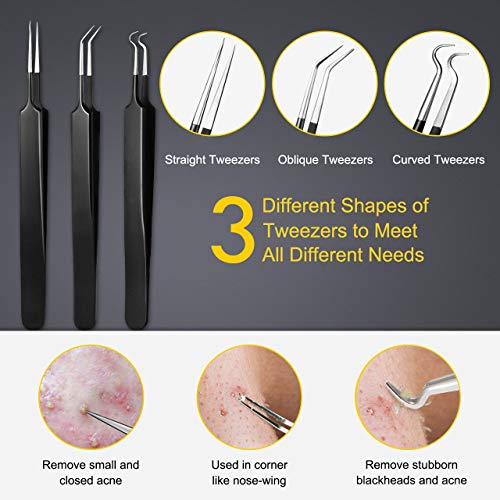 Pimple Popper Tool Kit - Boxoyx 10 Pcs Blackhead Remover Comedone Extractor Kit with Box for Quick and Easy Removal of Pimples, Blackheads, Zit Removing, Forehead,Facial and Nose (Black)