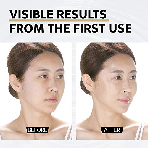 DOCTORCOS Silicone Skin Mask | Face Lifting Double Chin Reducer | V Line Lifting | Under Eye Mask | Forehead Wrinkles Treatment | Korean Skin Care