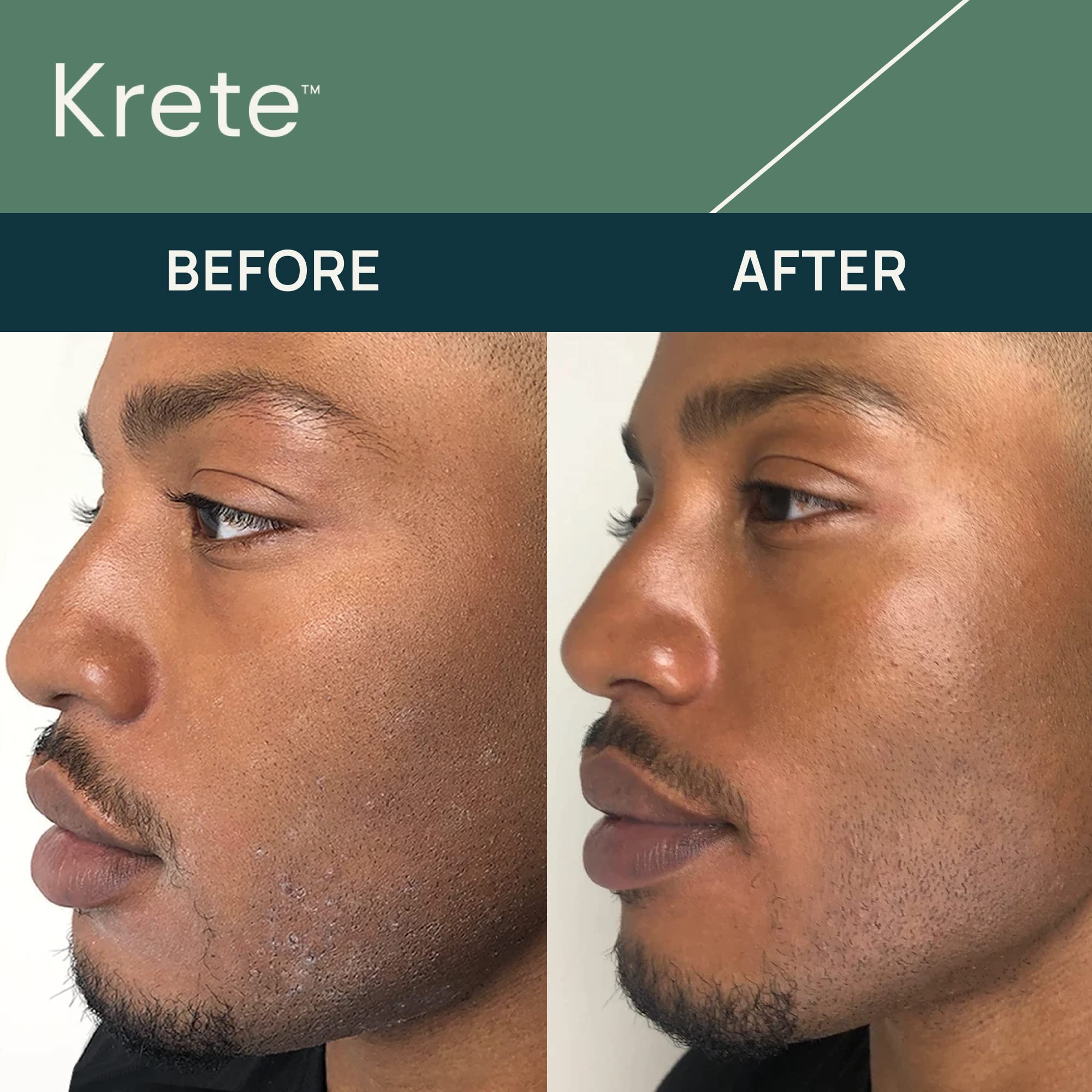 KRETE 30-Seconds Hydrating Facial Serum for Men - Helps with the Appearance of Aging, Wrinkles, Eye Bags, & Redness - Moisturize, Smooth, Hydrate, & Protect Your Skin - Oil-Free, All Skin Types