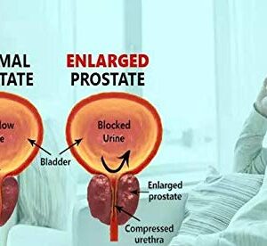 Prostate Gland Health Care Device for Men Prostatitis Pelvic Inflammation