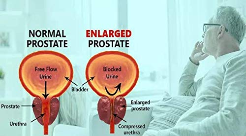 Prostate Gland Health Care Device for Men Prostatitis Pelvic Inflammation