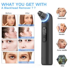 Blackhead Remover Pore Vacuum, Upgraded Pore Cleanser with Blue Light- Rechargeable Acne Extractor LED Display, Whitehead Removal, Facial Firming, Oil Reducing for Women & Men (202B-Black)