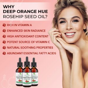 Jeune Naturelle Rosehip Oil Organic, From Fruit & Seeds, Pure, Raw, Virgin, Cold Pressed, Undiluted Body Oil For Skin Care, For Hair Oil, Gua Sha, Cuticle Oil, Face Oil, Organic Rosehip Seed Oil, 2 oz