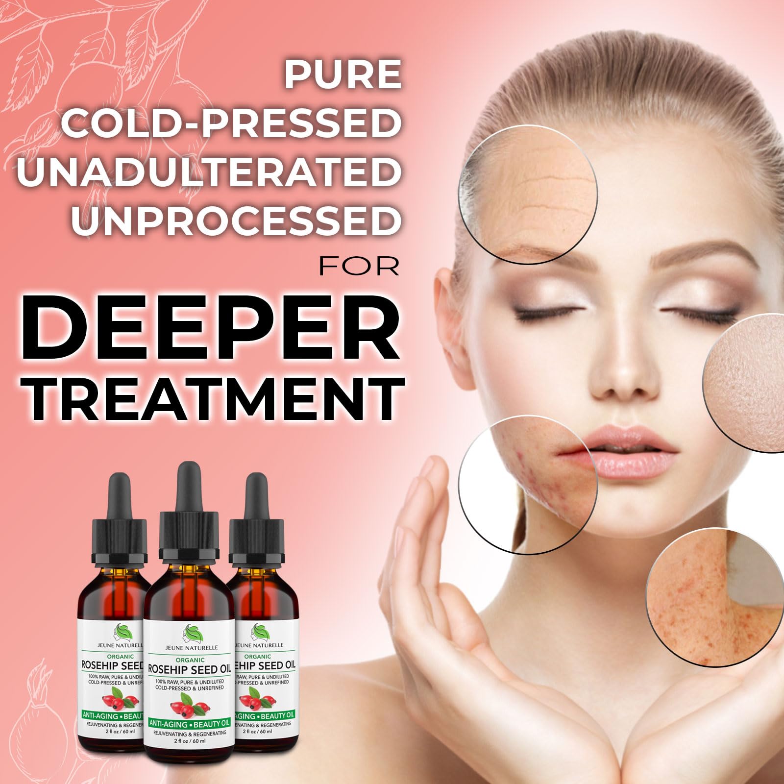 Jeune Naturelle Rosehip Oil Organic, From Fruit & Seeds, Pure, Raw, Virgin, Cold Pressed, Undiluted Body Oil For Skin Care, For Hair Oil, Gua Sha, Cuticle Oil, Face Oil, Organic Rosehip Seed Oil, 2 oz