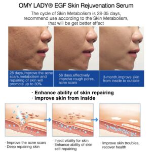 EGF Skin Rejuvenation Serum & Epidermal Growth Factor Powder Kit, Moisturizing Removing Wrinkles, Fine Lines and Pigmentation, Acne Scars Treatment Facial Repairing Serum