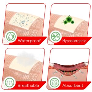 FRESINIDER Silicone Foam Dressing with Adhesive Border – Wound Dressing Bandage – Silicone Foam Pad – Pack of 5 – 3 x 3 Inches Large Waterproof Bandages – Self Adhesive Wound Care and Dressings