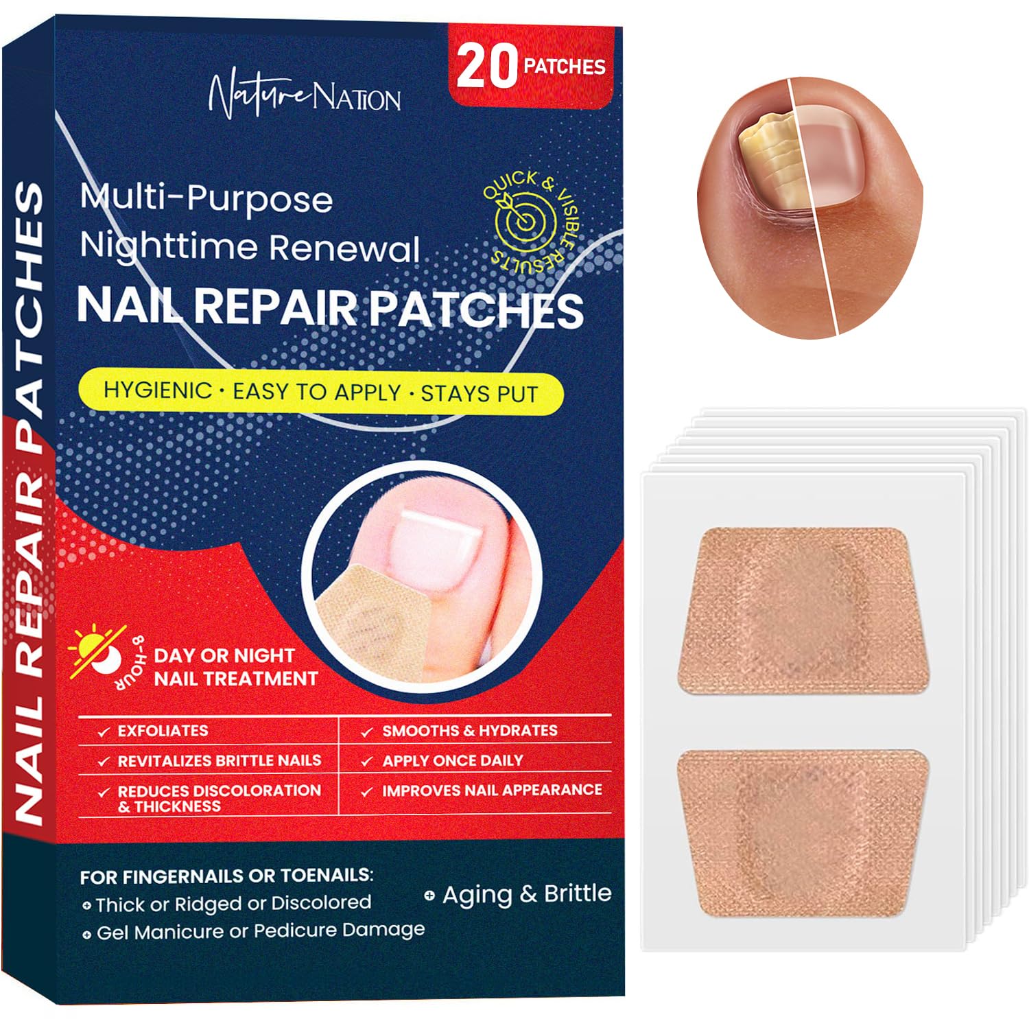 Multi-Purpose Fungus Nail Patches, Toenail Fungus Treatment, Nail Fungus Treatment for Toenail, Ingrown Toenail Treatment, Toe Nail Fungus Treatment Extra Strength, Nighttime Fungal Nail Patches