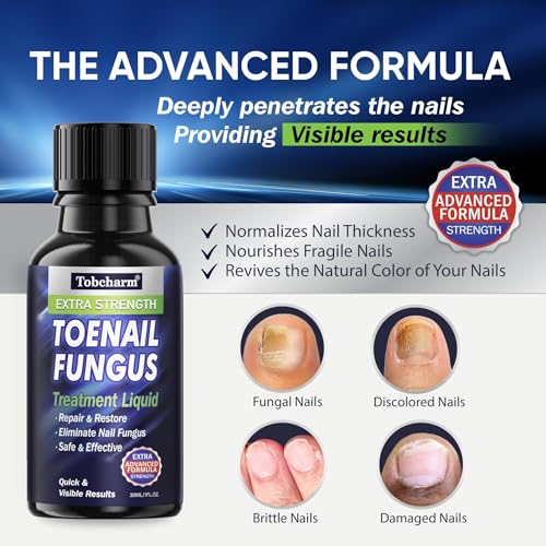 Tobcharm Toenail Fungus Treatment Extra Strength, Nail Fungus Treatment for Toenail, Fungus Nail Treatment, Nail Fungus Treatment for Fingernails (1oz)