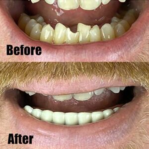 Instant Smile Comfort Fit Flexible Lower Teeth