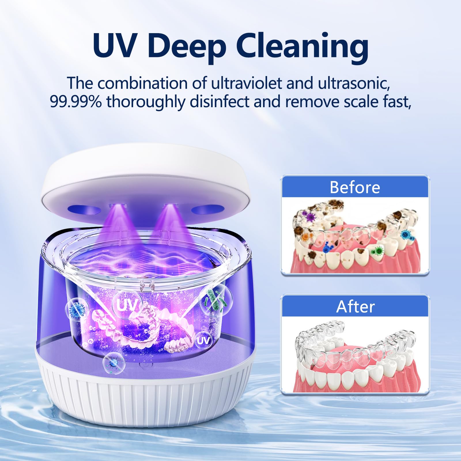 THISONG Ultrasonic UV Cleaner for Dentures, Orthodontic Appliances, Whitening Trays, Toothbrush Heads, Diamond, Jewelry, 5/10 Minutes Ultrasonic Retainer Cleaner with UV Light