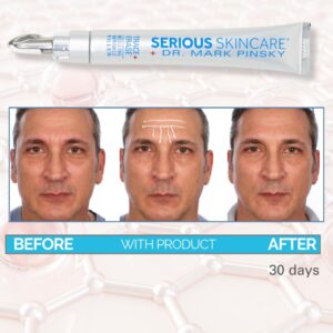 Serious Skincare - Dr. Mark Pinsky - Trace + Erase Needle Free Wrinkle Filler - Fills Visible Deep Lines, Wrinkles and Creases - Helps Restore Skin's Elasticity and Tone - Face and Neck 1 Fl Oz