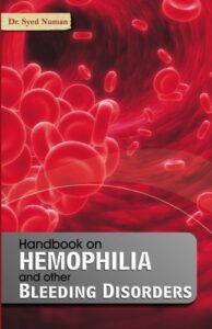 handbook on hemophilia and other bleeding disorders