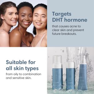 Clearogen Hormonal Acne Solution Natural Anti-DHT Ingredients Deluxe Set Original Formula Benzoyl Peroxide 2 Month Supply 3 Piece Set