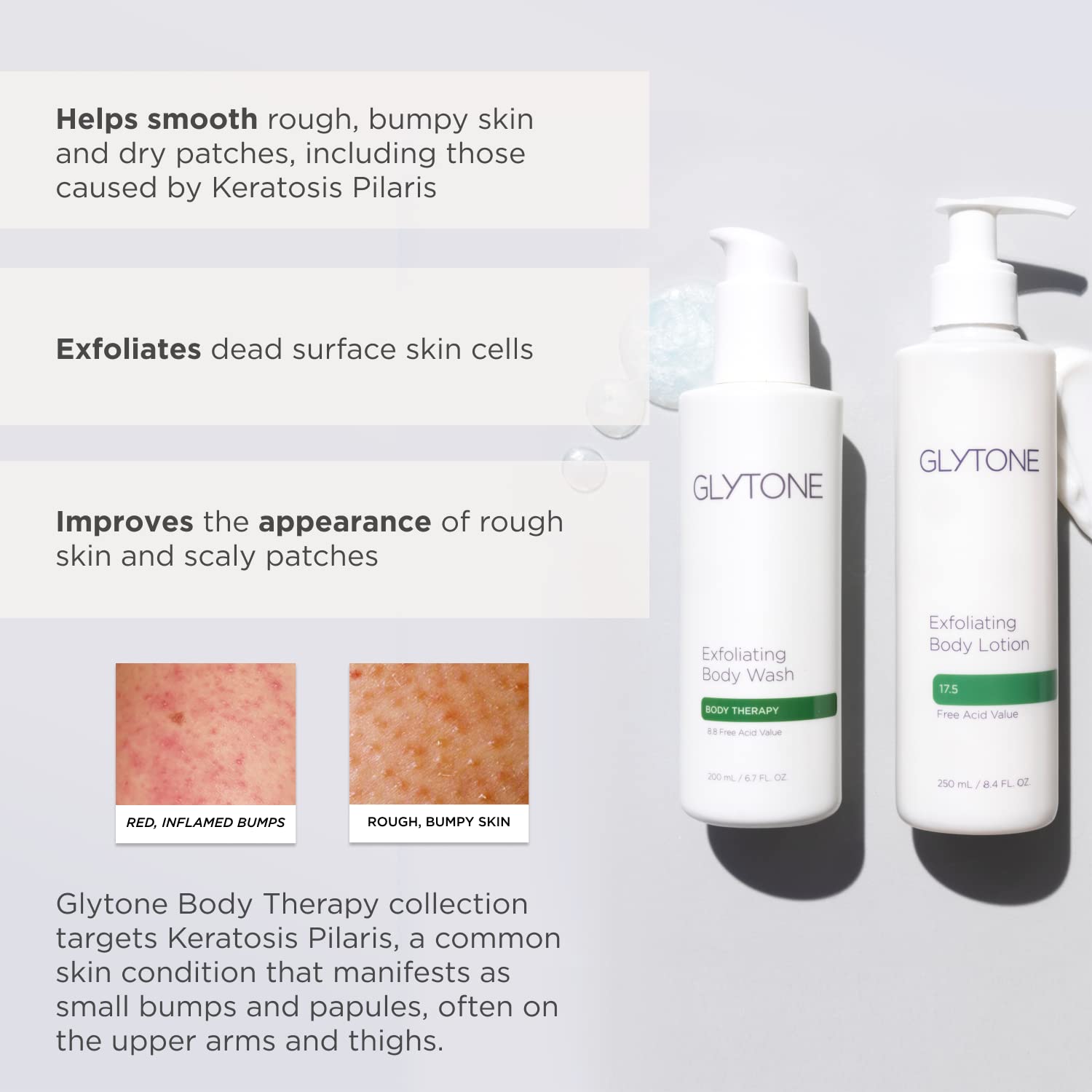 Glytone Exfoliating Body Lotion 17.5% Free Acid Value Glycolic Acid - Keratosis Pilaris - Smooth Rough & Bumpy Skin - Oil & Fragrance-Free - 8.4 fl. oz.