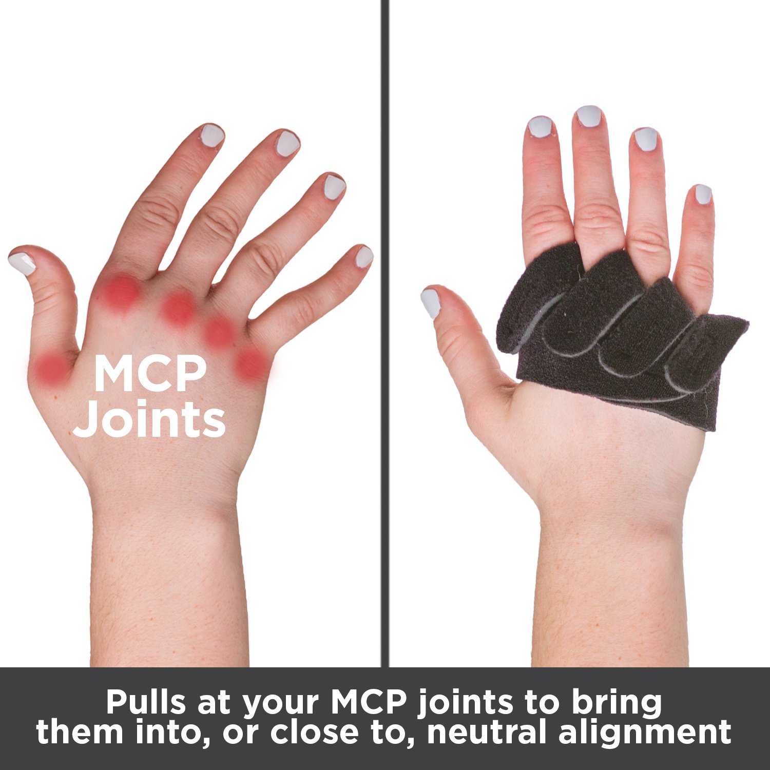 BraceAbility Ulnar Deviation & Drift Hand Splint | MCP Knuckle Joint Support Brace for Rheumatoid Arthritis & Tendonitis Pain Relief, Finger Straightener & Stretcher Glove - S (SM/MED) Right