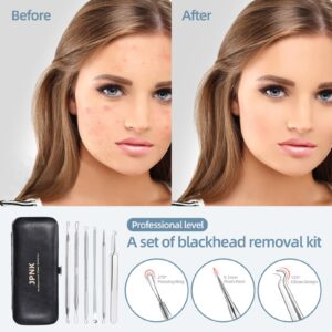 JPNK Blackhead Remover Tool Comedones Extractor Acne Removal Kit for Blemish, Whitehead Popping, 6 Pcs Zit Removing for Nose Face Tools with a Leather Bag