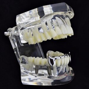 Vampire Half Grillz Fang Slim Silver Tone Bottom Lower Row Slugs Teeth Hip Hop Grills