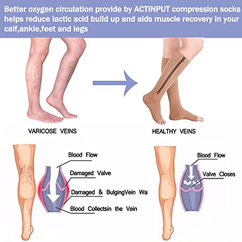 2 Pairs Compression Socks Toe Open Leg Support Stocking Knee High Socks with Zipper (Nude, L/XL) …