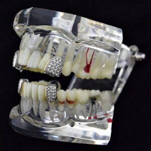 Single Cap Tooth Set CZ Cubic Zirconia Silver Tone 2 Top Teeth Plus Two Bottom Iced Canine Cap Grills