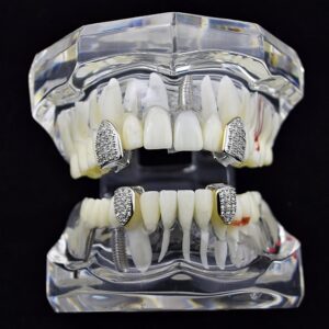 Single Cap Tooth Set CZ Cubic Zirconia Silver Tone 2 Top Teeth Plus Two Bottom Iced Canine Cap Grills