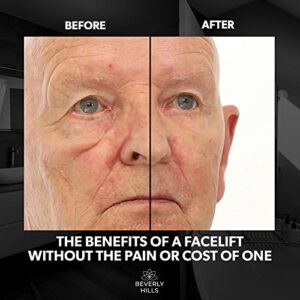 Beverly Hills Mens Instant Facelift and Eye Serum Treatment for Dark Circles, Puffy Eyes, and Wrinkles