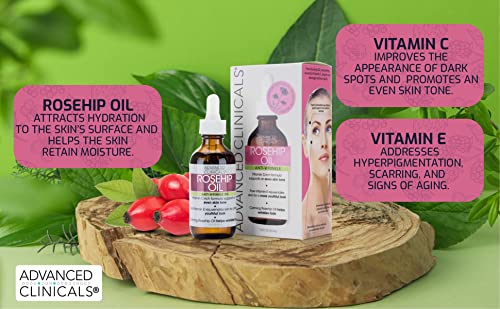 Advanced Clinicals Rosehip Oil Facial Skin Care Serum Moisturizer Face Oil W/Vitamin C & Vitamin E For Reducing Appearance Of Sun Damage Skin, Age Spots, & Wrinkles, 1.8 Fl Oz (Pack of 2)