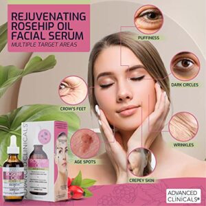 Advanced Clinicals Rosehip Oil Facial Skin Care Serum Moisturizer Face Oil W/Vitamin C & Vitamin E For Reducing Appearance Of Sun Damage Skin, Age Spots, & Wrinkles, 1.8 Fl Oz (Pack of 2)