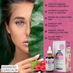 Advanced Clinicals Rosehip Oil Facial Skin Care Serum Moisturizer Face Oil W/Vitamin C & Vitamin E For Reducing Appearance Of Sun Damage Skin, Age Spots, & Wrinkles, 1.8 Fl Oz (Pack of 2)