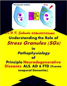 understanding the role of stress granules (sgs) in the pathophysiology of principle neurodegenerative diseases: als, ad & ftd (frontotemporal dementia).