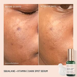 Biossance Squalane + Vitamin C Dark Spot Serum. Powerful, Lightweight Serum with 10% Vitamin C to Brighten Skin, Fade Dark Spots, Reduce Pigmentation and Prevent Discoloration (1.01 ounces)