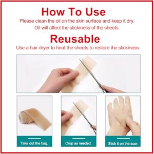 Silicone Scar Sheets (1.6” x 120” Roll-3M), Silicone Scar Tape Roll, Scar Silicone Strips, Reusable, Professional Scar Removal Sheets for C-Section, Surgery, Burn, Keloid, Acne et