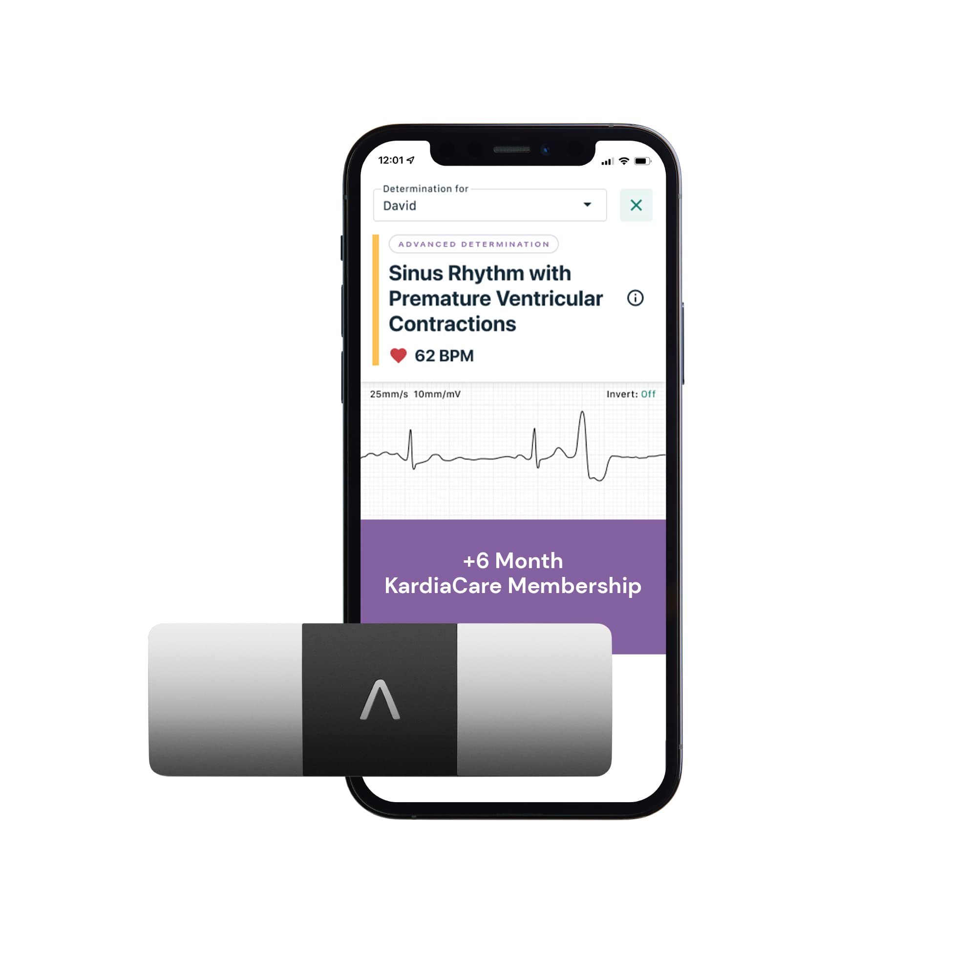 KardiaMobile Six-Lead Personal EKG Device - Record EKGs at Home and Detect Irregular Heartbeats - Includes Access to 6 Months of KardiaCare Heart Health Membership - by AliveCor