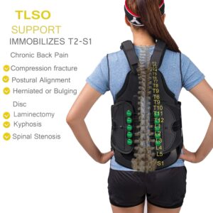 TLSO Thoracic Full Back Brace - Universal Treat Kyphosis, Compression Fractures, Osteoporosis, Upper Spine Injuries, and Pre or Post Surgery with Hard Lumbar Support for Men and Women (Size L)