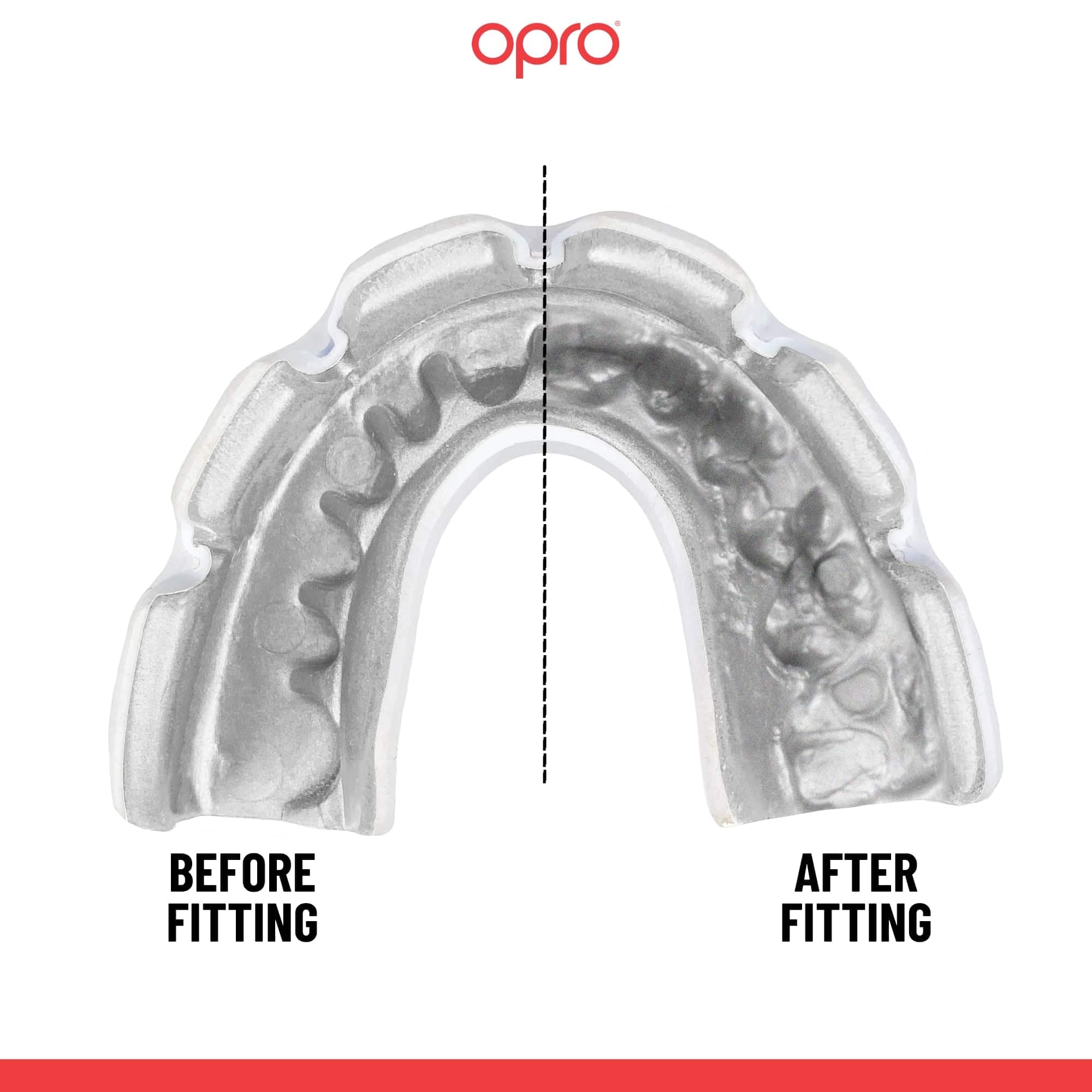 OPRO Instant Custom-Fit Braces Mouth Guard, Dentist Mouthguard Featuring Revolutionary Fitting cage, Ultimate Comfort, Protection & Fit, Braces Gum Shield for Rugby, Boxing, MMA, Hockey (Gold)