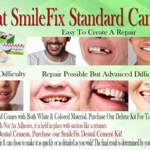 SmileFix Standard Dental Repair Kit - Color Matching Compound - For Missing Or Damaged Teeth - Fix Gaps, Broken Tooth, Spaces - Durable Repair - Fast & Easy - Confident Smiles