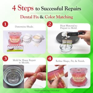 SmileFix Standard Dental Repair Kit - Color Matching Compound - For Missing Or Damaged Teeth - Fix Gaps, Broken Tooth, Spaces - Durable Repair - Fast & Easy - Confident Smiles