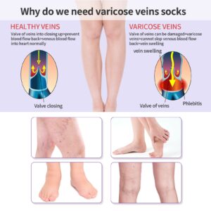 Open Toe Compression Socks Compression Stockings Toeless Support Hose 20 -30 mmHg XX-Large