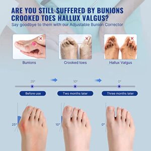 Fitgeno Bunion Corrector Women & Men Big Toe: Foot Straightener Splint Brace - Adjustable Bunyan Correction Orthopedic for Hallux Valgus Pain Relief 2 Pcs