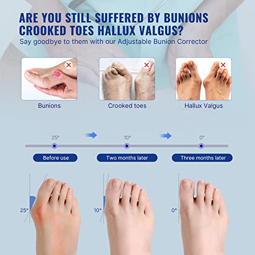 Fitgeno Bunion Corrector Women & Men Big Toe: Foot Straightener Splint Brace - Adjustable Bunyan Correction Orthopedic for Hallux Valgus Pain Relief 2 Pcs