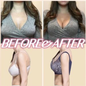 Dfcdcoo PrettyHealth Lymphvity Detoxification and Shaping & Powerful Lifting Bra for Women (skin colour,XL)