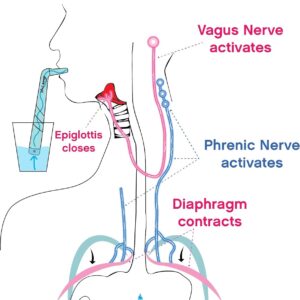 HiccAway Hiccup Straw - Stops Hiccups Naturally & Fast - As Seen On Shark Tank - Clinically Proven Relief for All Ages, Children & Adults - Safe, Lightweight, & Reusable (HiccAway Blue) 1 Pack