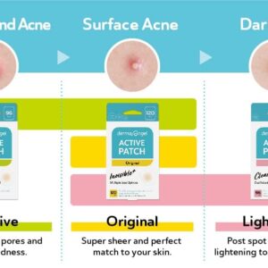 DERMA ANGEL Ultra Invisible Dark Spot Patches for Post Acne Pimple, Acne Spot Treatment - Day and Night Use - UPGRADED (Post Acne - 96 Count - 1 Size)