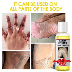 Peeling Oil for Dark Skin, Yellow Peeling Oil, Strong Peeling Oil Extra Strength, Exfoliating Peeling Solution for Body All Skin Type -110ML/3.66 OZ