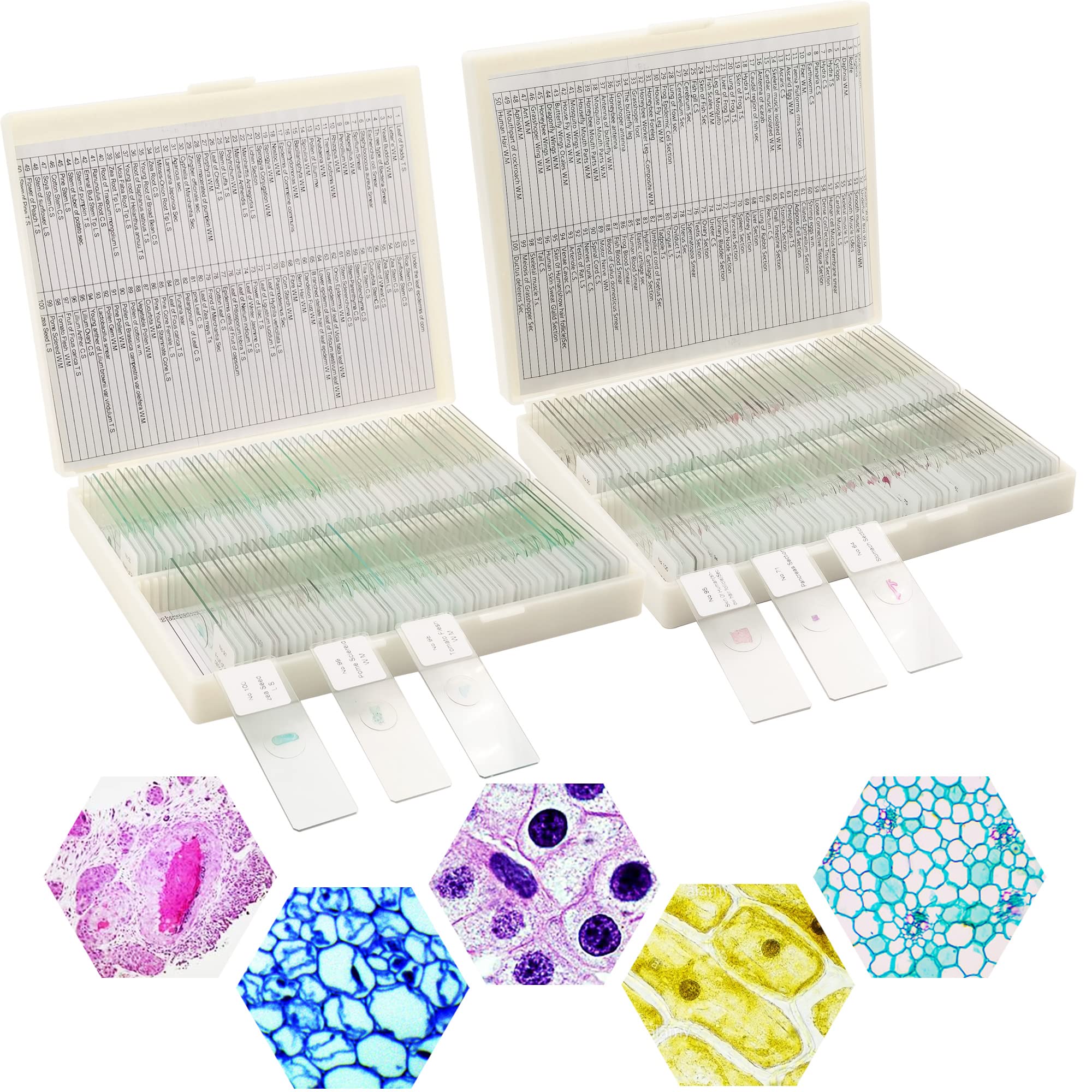 Prolee 200 Packs Microscope Slides, 100 Plants & 100 Animal Tissues Includes Labels and Case for Biological Science Education