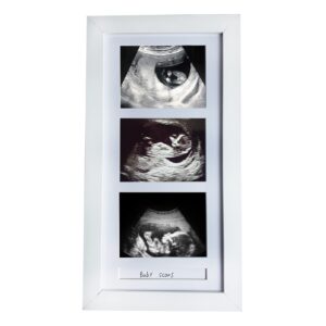 trlry triple ultrasound picture frames, sonogram picture frame 3 photos,pregnancy announcements,pregnancy gifts for first time moms,first time mom gift,white,ultrasound photo album